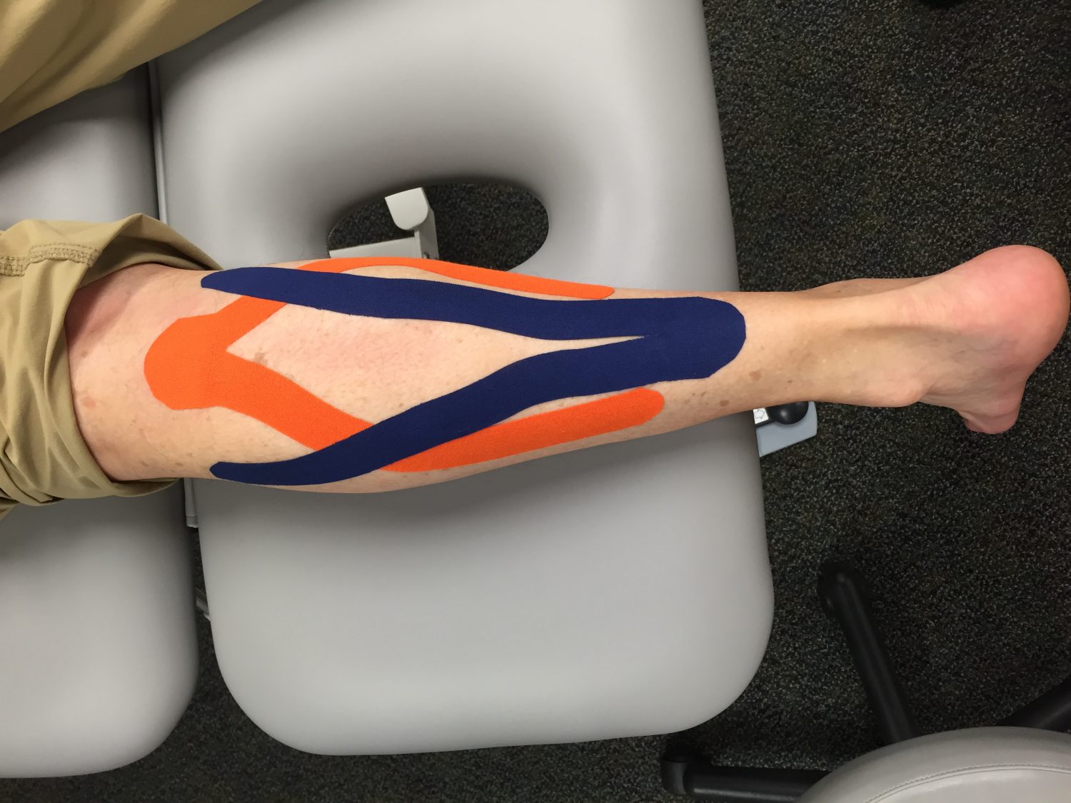 Kinesio Taping - Active PT Solutions